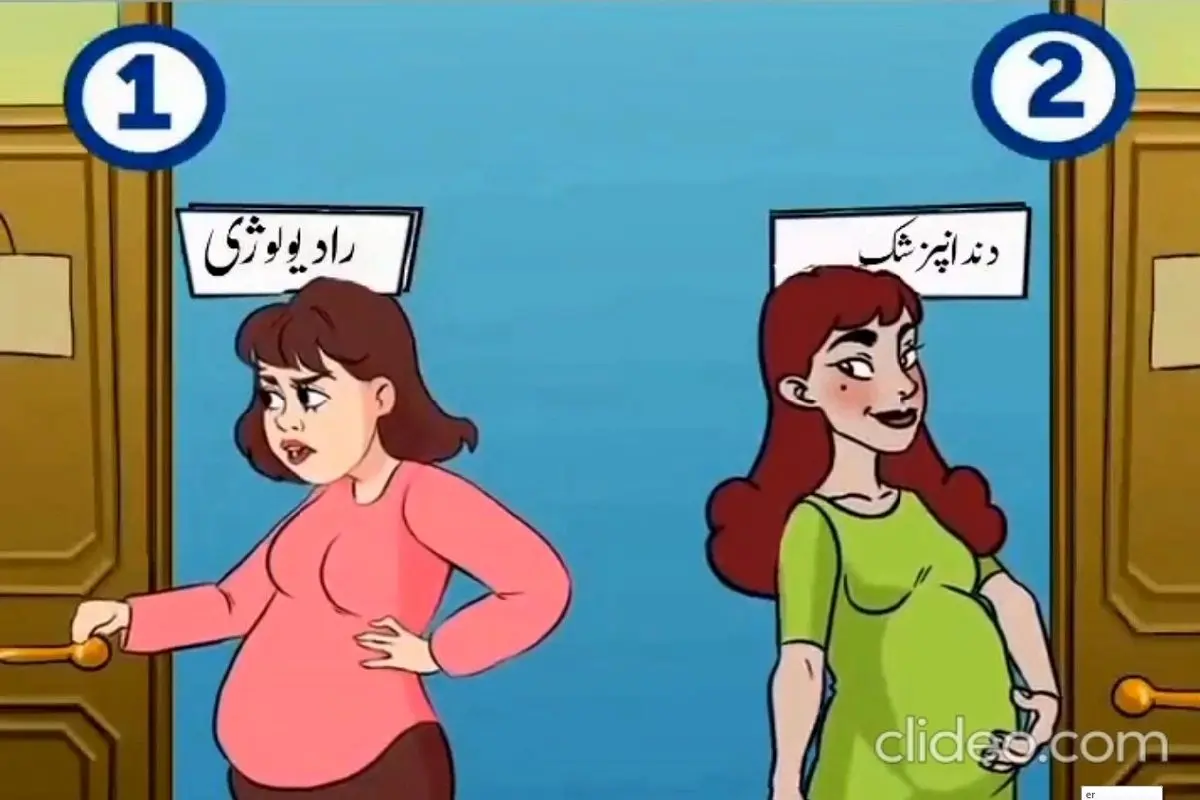 هوش تصویری؛ اگه زدی رو دست هر تیز هوشه زودی بگو کدوم از این خانوم ها